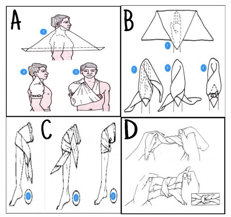 Asas Pertolongan Kecemasan di AsiaCamp - AsiaCamp
